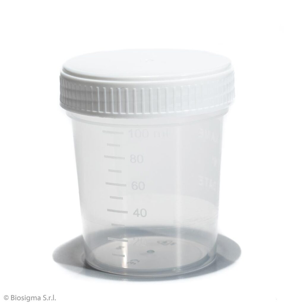 Urine containers - Biosigma: Biotechnology and Clinical